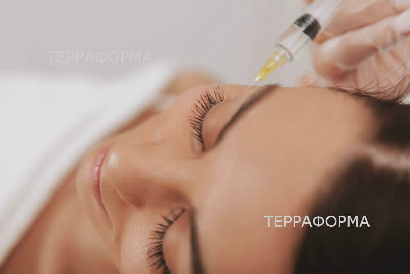 Карбокситерапия в клинике Терраформа Домодедово